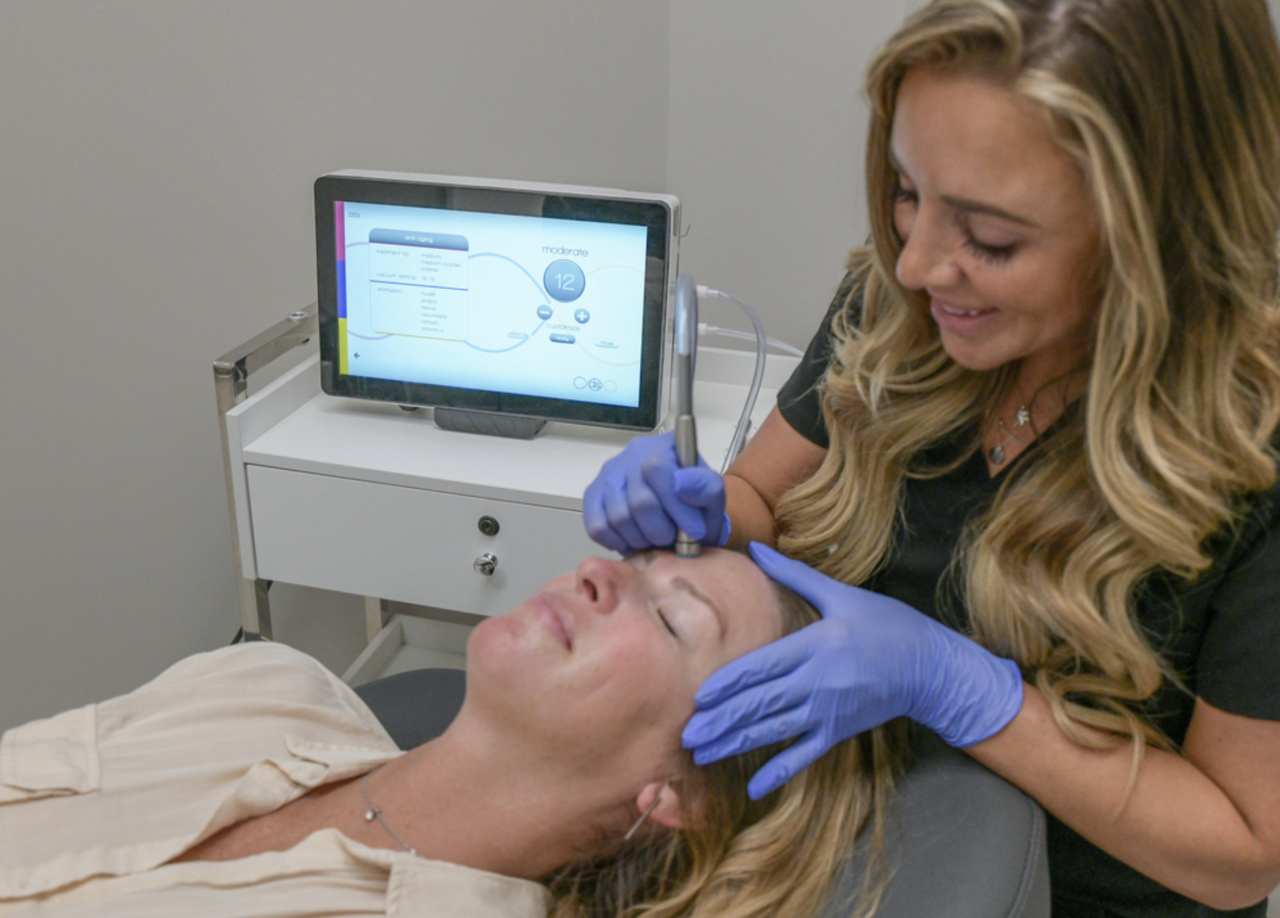 DermaSweep® Treatment Nashville - Curcio Dermatology